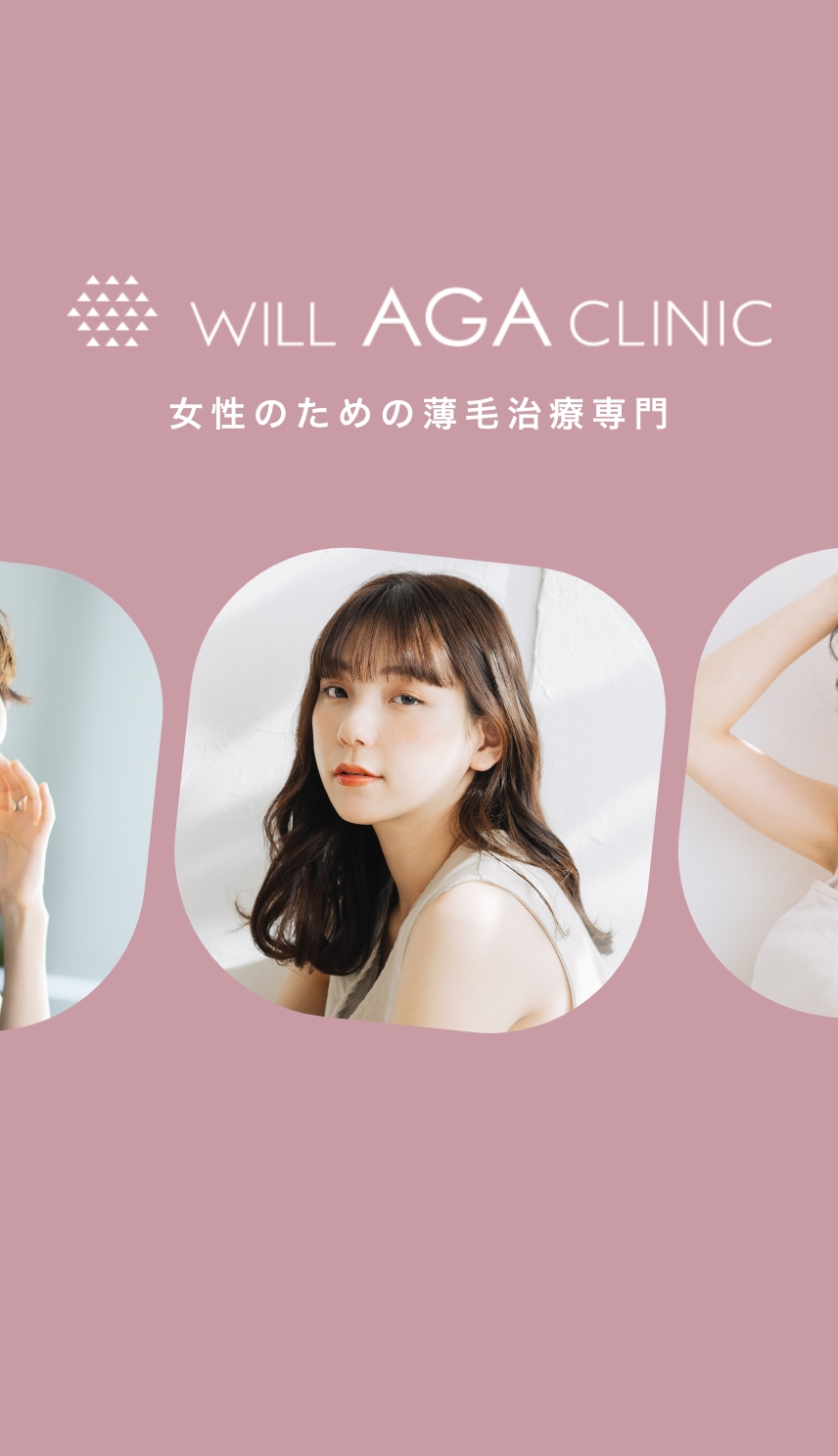 ウィルAGAクリニック | 女性のためのFAGA・抜け毛・薄毛治療の専門病院
